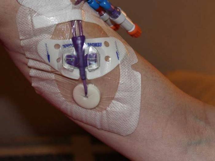 The MAGIC – Guide for PICC Use | Infusion Nurse Blog